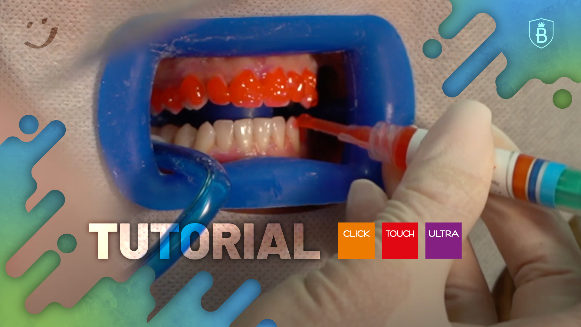 BlancOne in office system basic training: Arcus, Click, Touch, Ultra ...